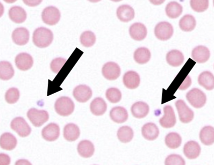 Thrombocyten of bloedplaatjes (zwart pijltje): Ze kunnen hier ...