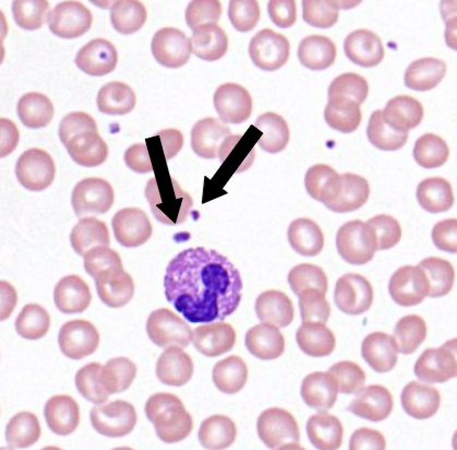 Thrombocyten of bloedplaatjes (zwart pijltje): Ze kunnen hier ...